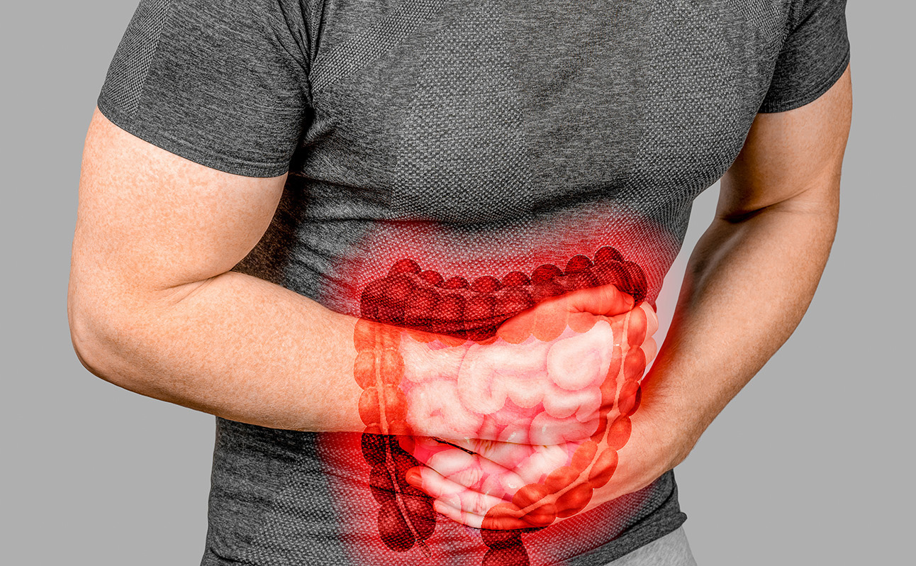 Novas Diretrizes para o Manejo da Doença de Crohn: Menos Colonoscopias ...